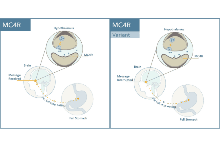 MC4R Gene Spotlight - Genomind